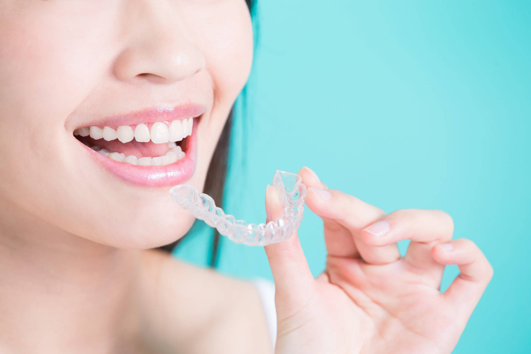 How To Build Your Clear Aligner Practice Odonto Clear Aligners
