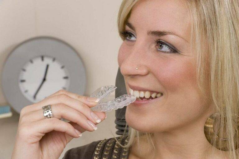 Enhancing Clear Aligner Treatment with Attachments and Auxiliary ...